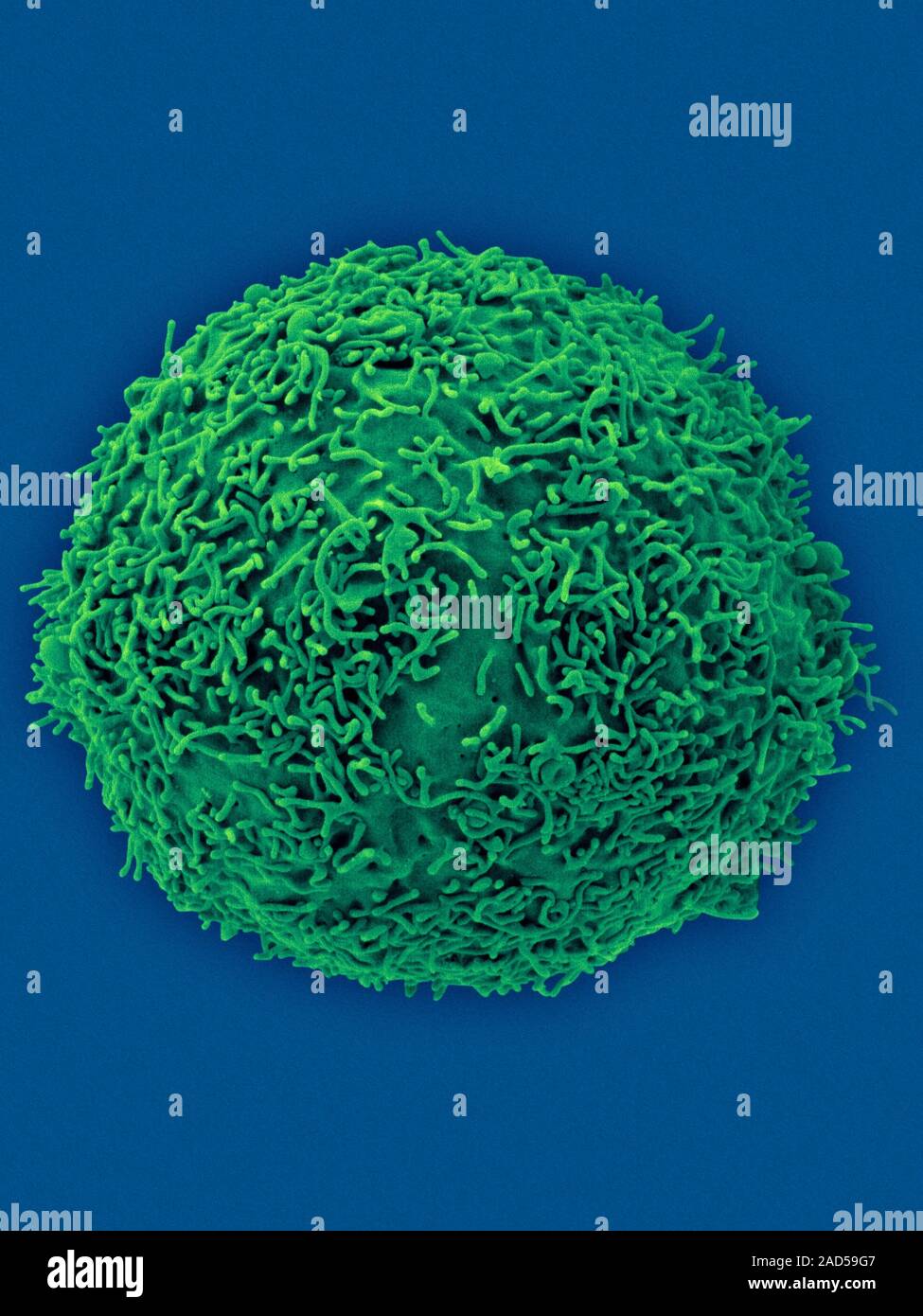 Human lymphoblast (Molt-4 cell line) from human bone marrow, coloured ...