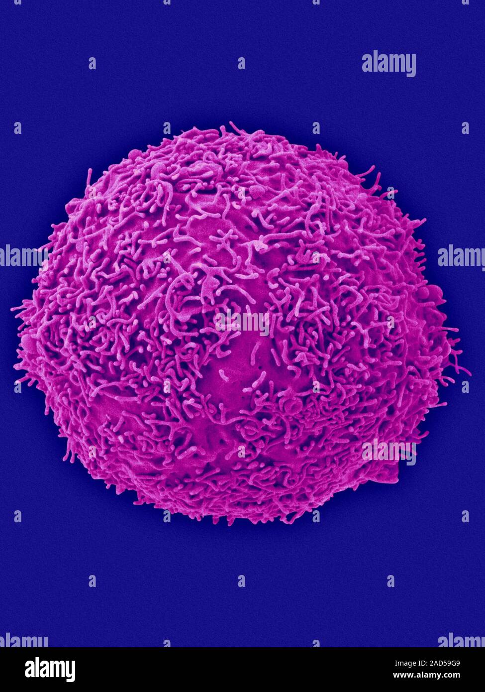 Human lymphoblast (Molt-4 cell line) from human bone marrow, coloured ...