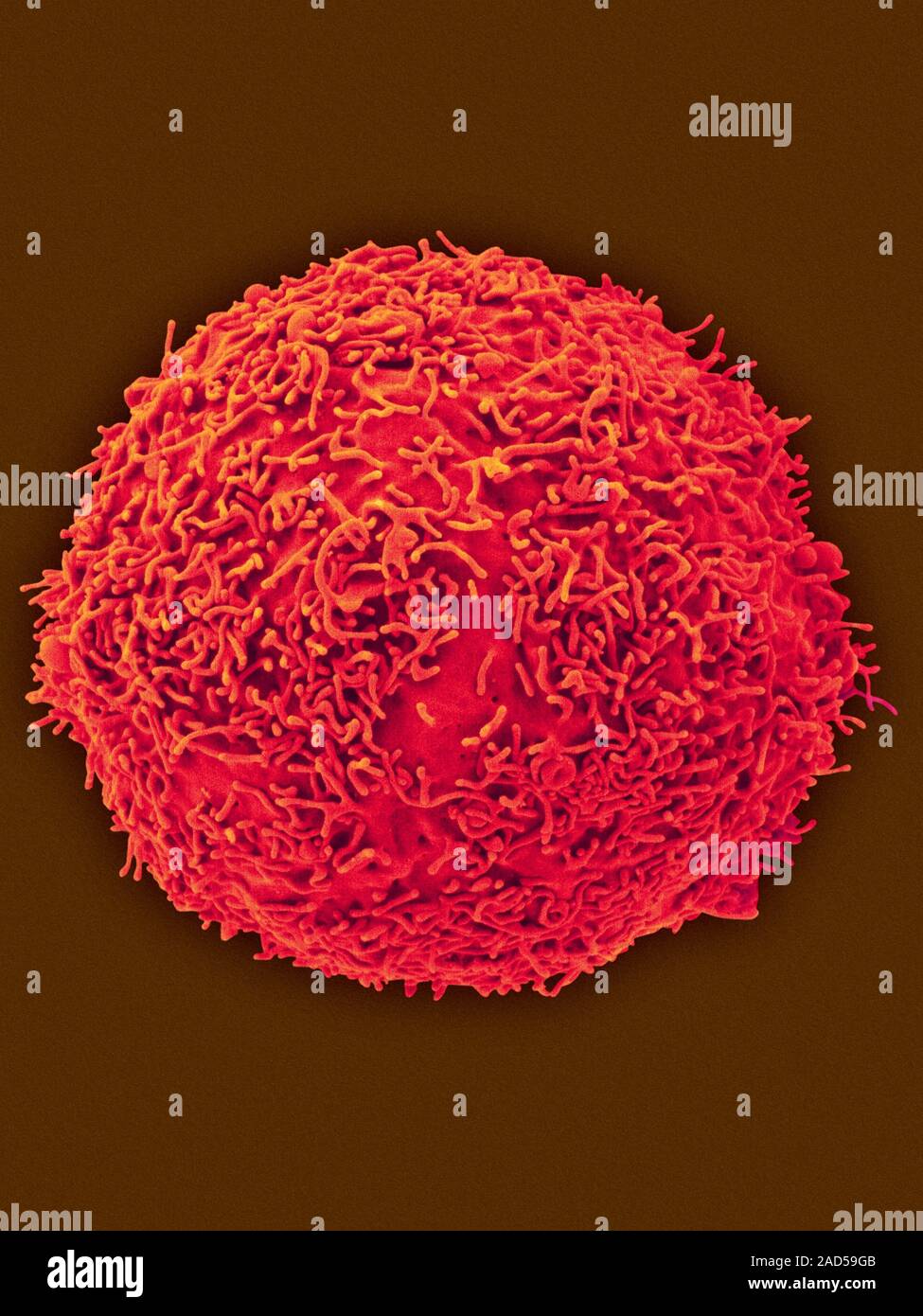 Human lymphoblast (Molt-4 cell line) from human bone marrow, coloured ...