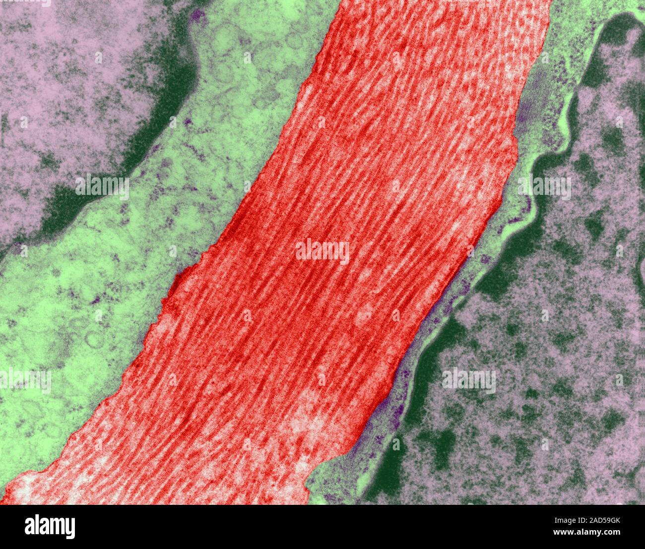 Collagen fibres (connective tissue) between human skin epithelial cells ...