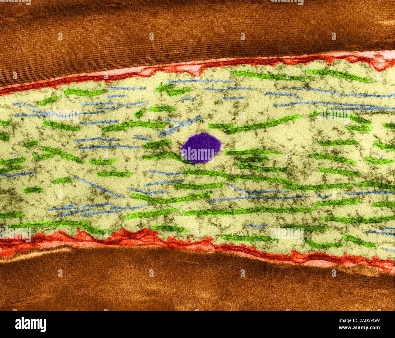 Myelinated axon from a central nervous system neuron (mammal ...