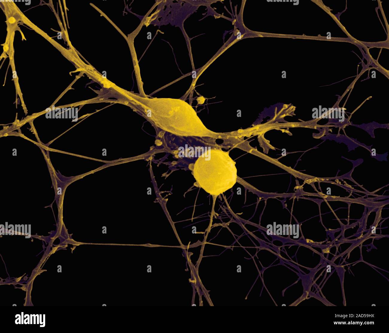 Neuron (elongated cell) and astrocyte (round cell) from the central ...