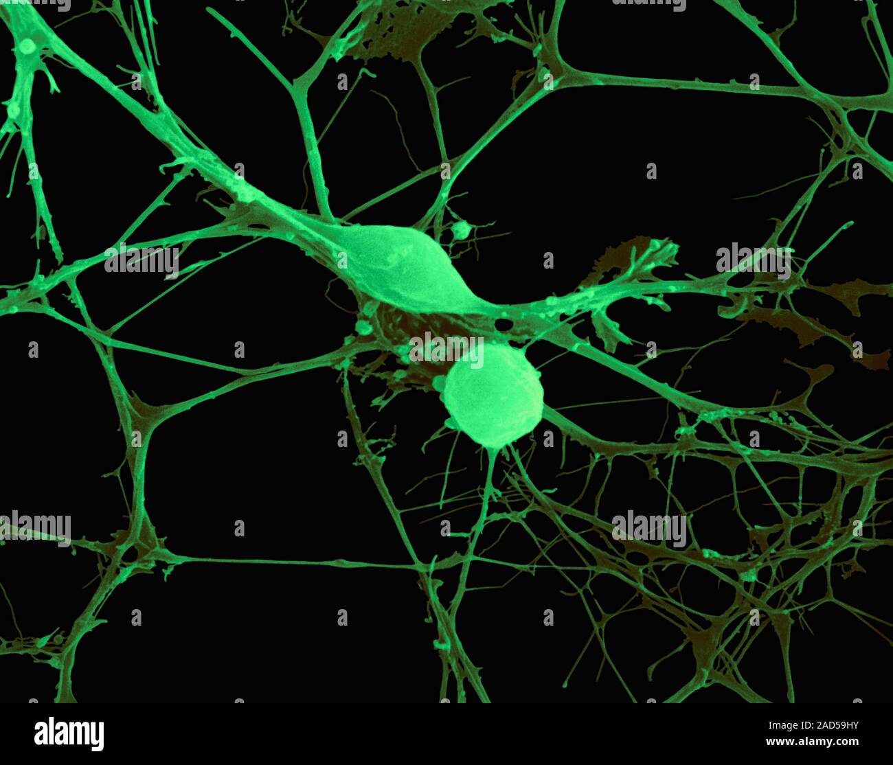 Neuron (elongated cell) and astrocyte (round cell) from the central ...