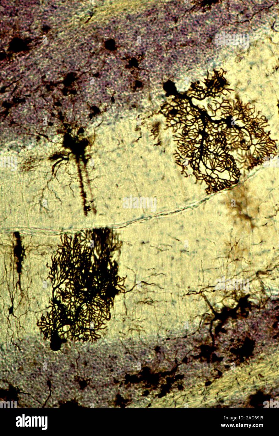 Brightfield light micrograph of Purkinje neurons (nerve cells) in the ...