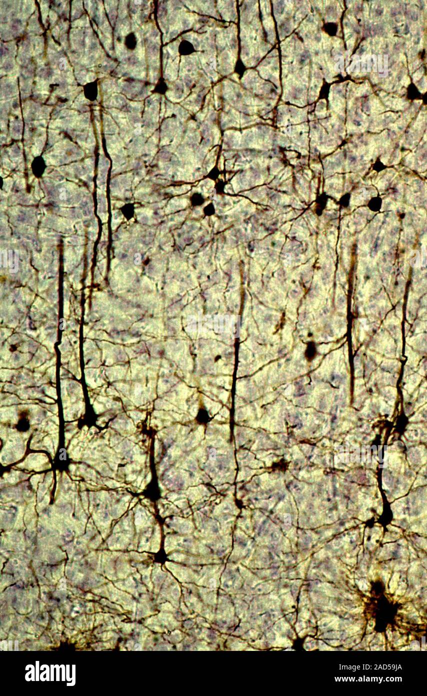 Brightfield light micrograph of pyramidal neurons (nerve cells) in the ...