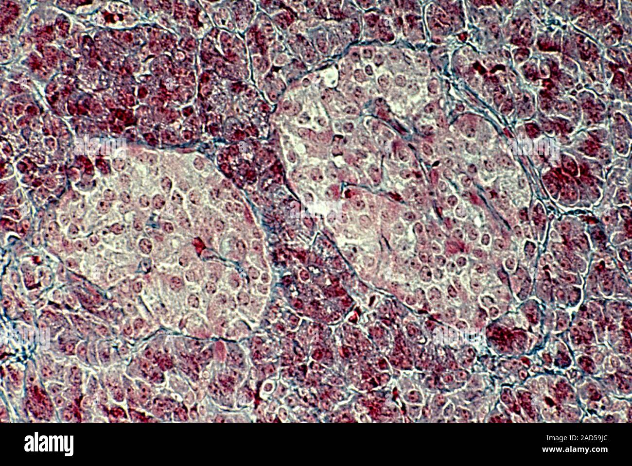 Brightfield light micrograph of human pancreas Islets of Langerhans and ...