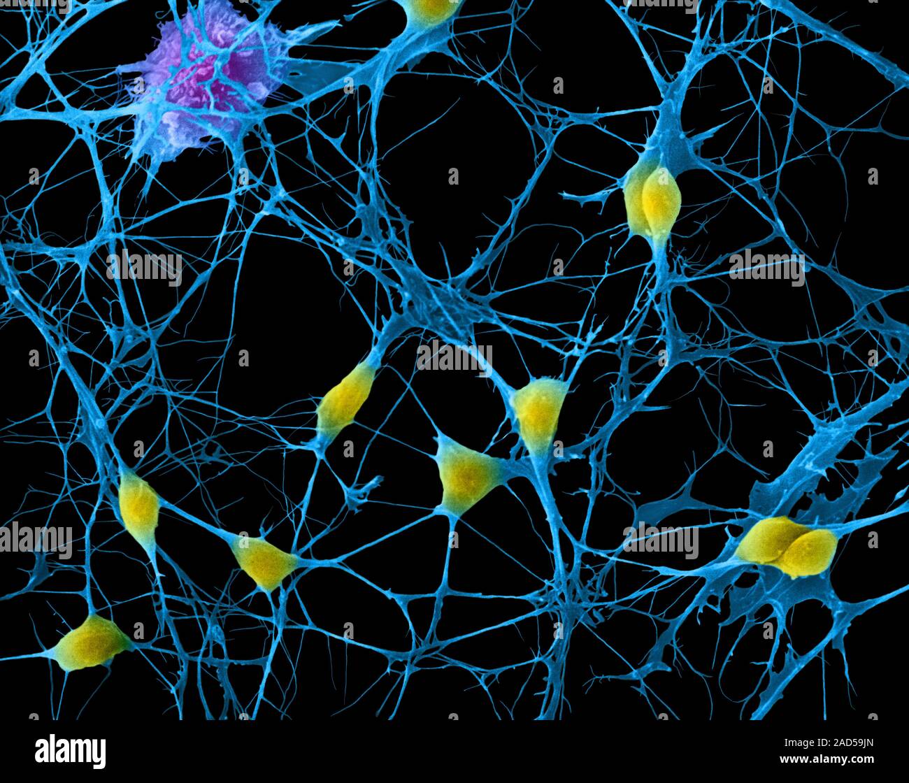 Cortical brain neurons (nerve cells) growing in culture, coloured ...