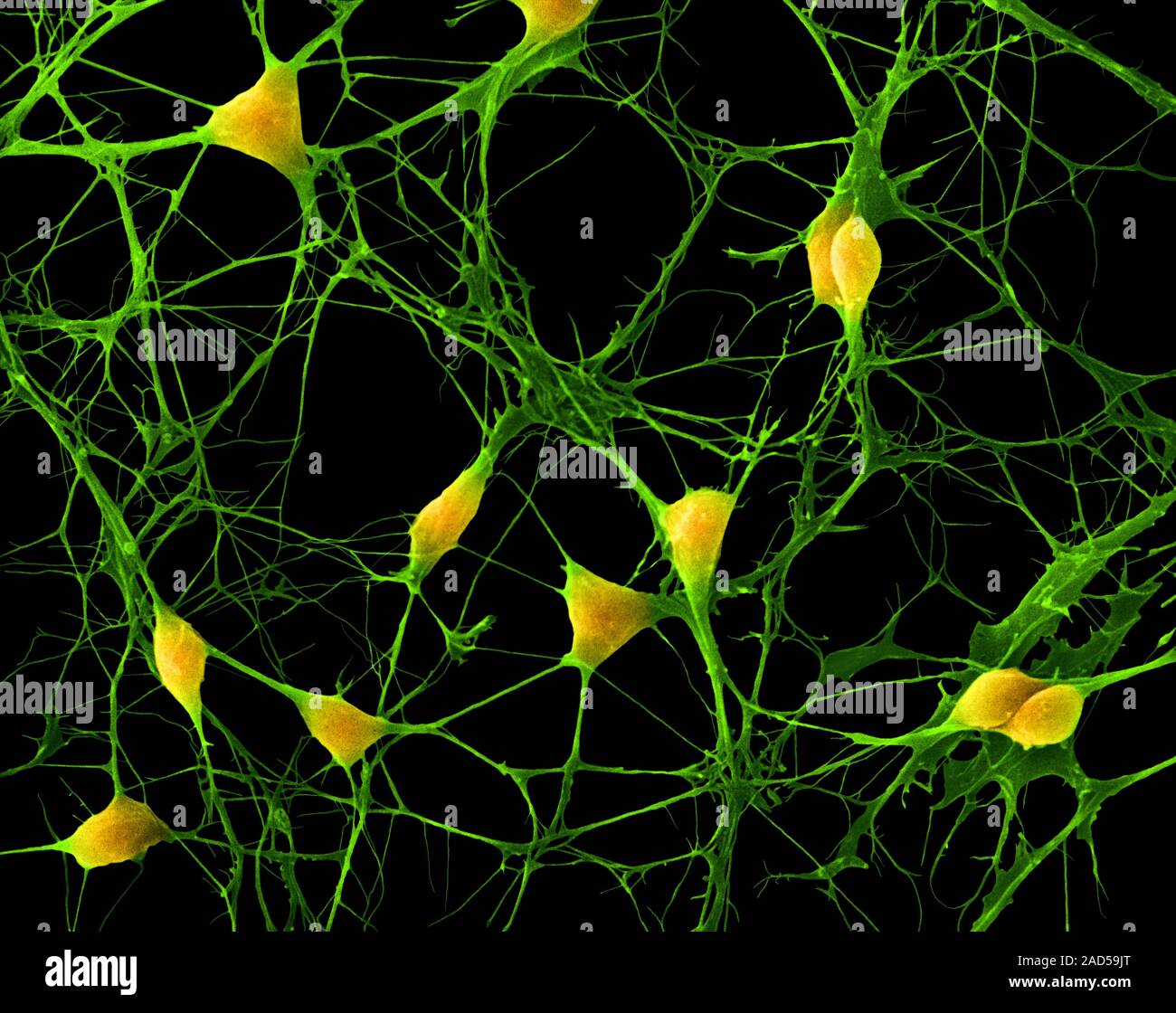 Cortical brain neurons (nerve cells) growing in culture, coloured ...