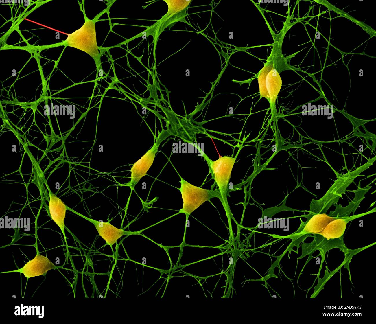 Cortical brain neurons (nerve cells) growing in culture, coloured ...