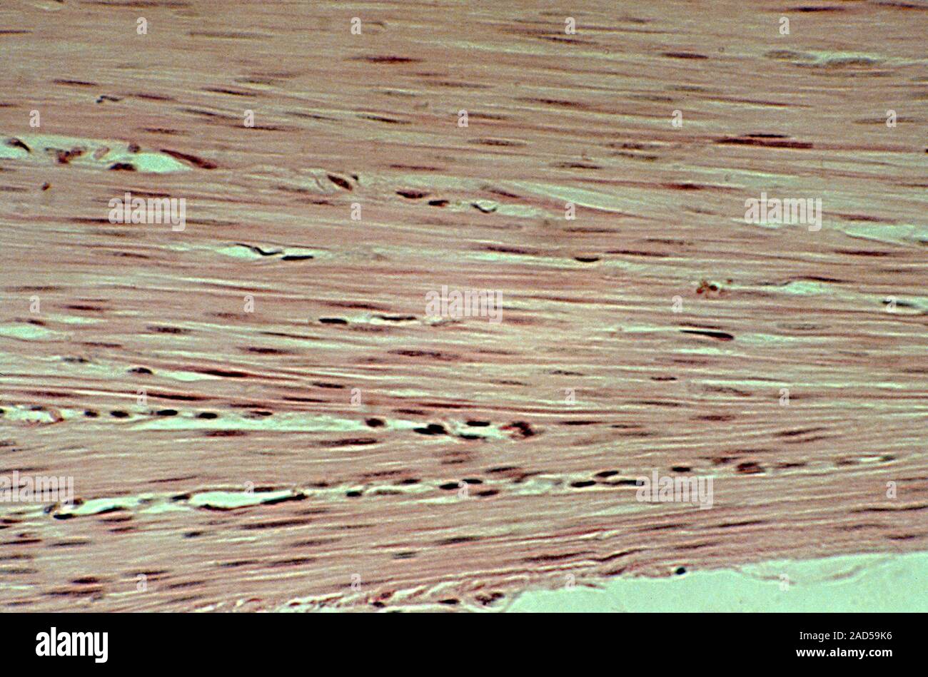 Brightfield light micrograph of human trachea smooth muscle cells. The ...