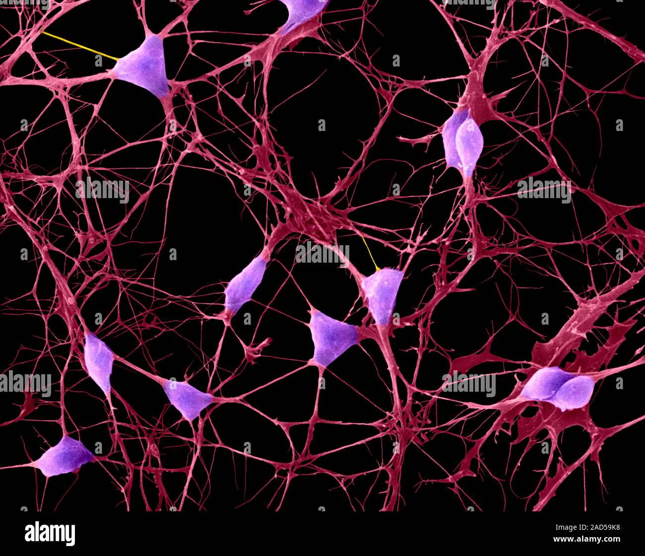 Cortical brain neurons (nerve cells) growing in culture, coloured ...