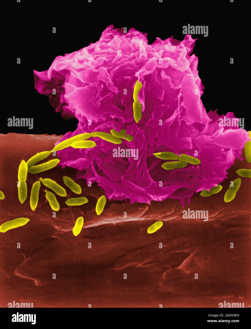Alveolar macrophage phagocytosis of E. coli on the outer surface of a ...