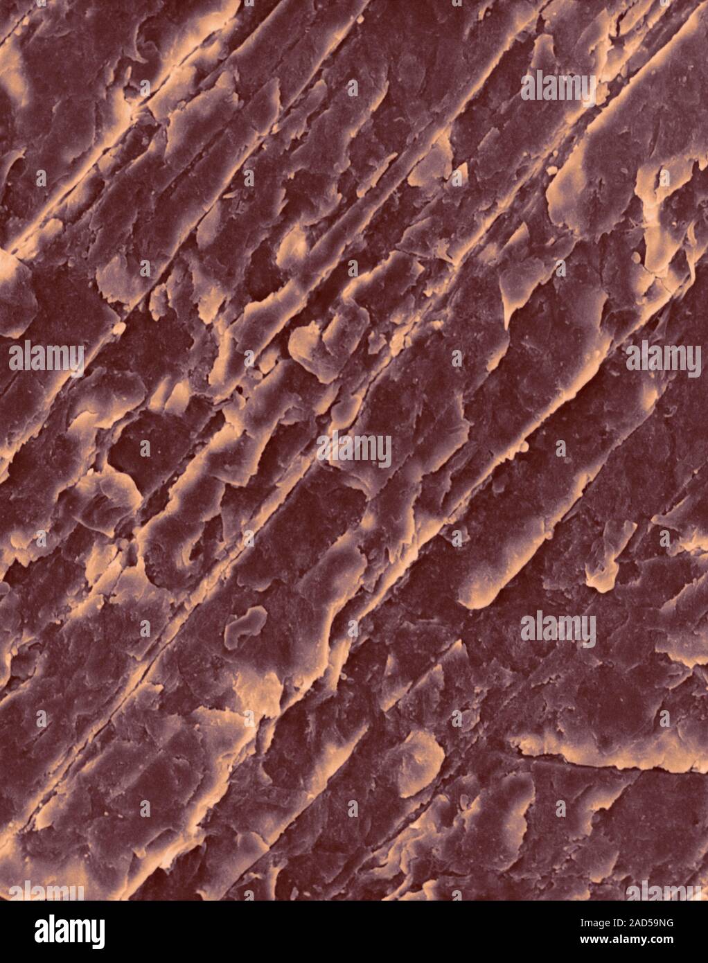 Human fingernail surface, coloured scanning electron micrograph (SEM ...