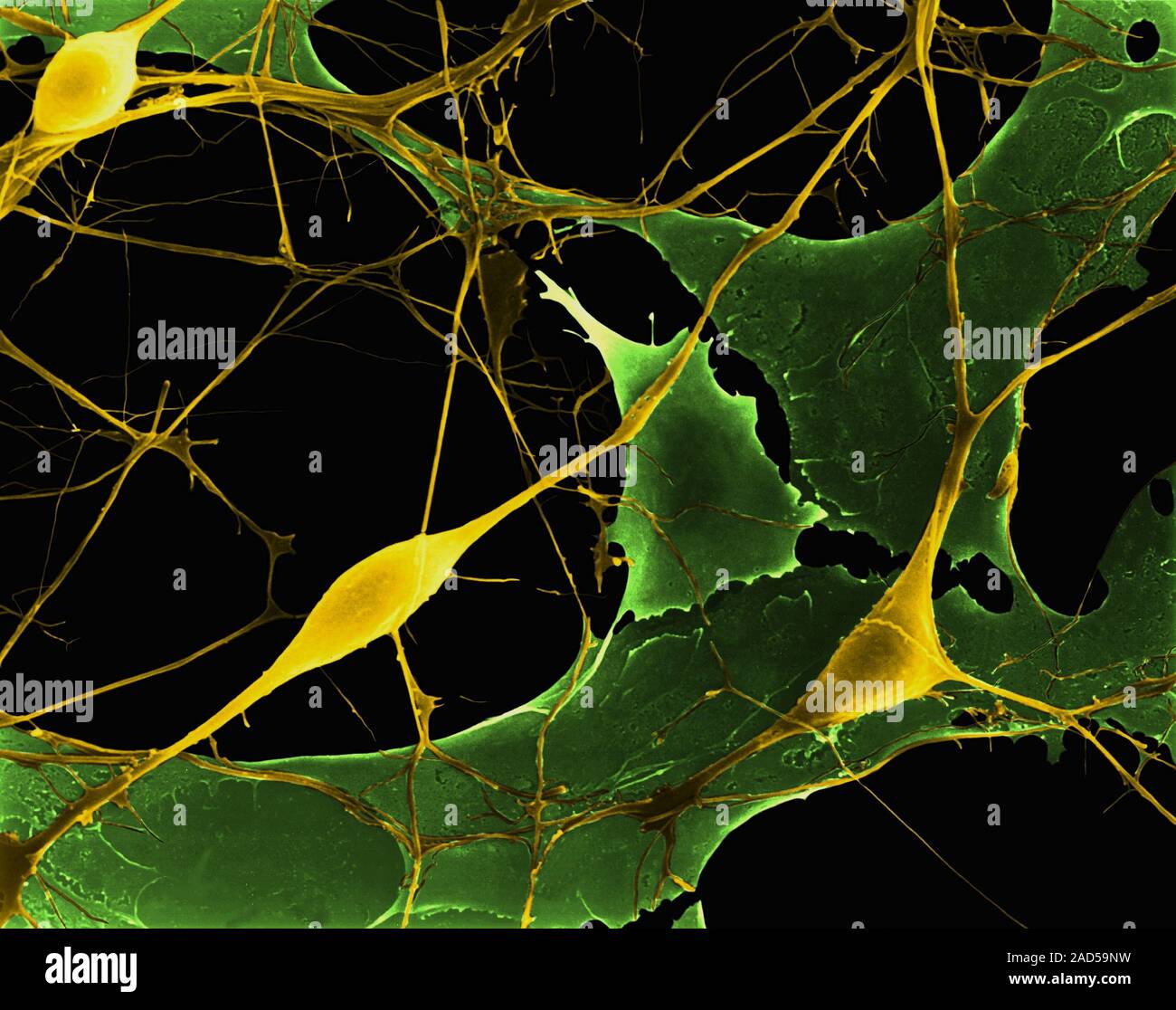 Cortical pyramidal neurons from the central nervous system growing on a ...