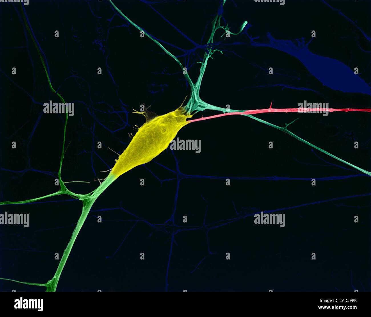 Cortical pyramidal neuron growing in culture, coloured scanning ...