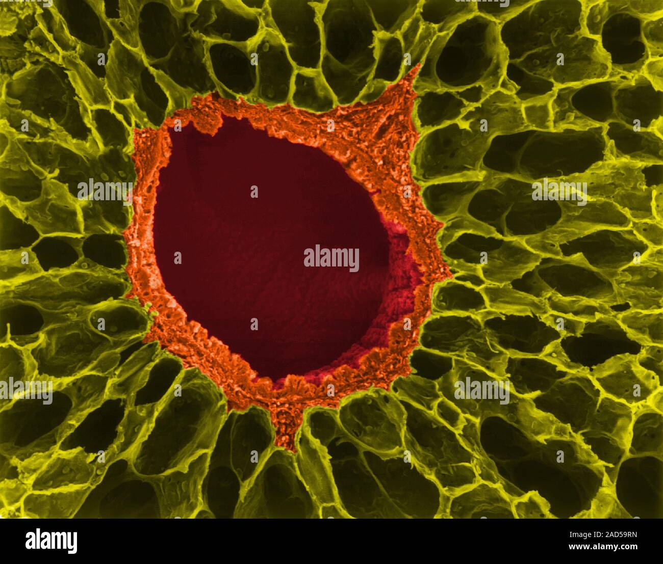 Human lung alveoli and venule (small blood vein), coloured scanning ...