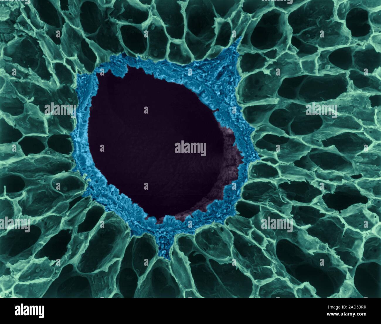 Human lung alveoli and venule (small blood vein), coloured scanning ...