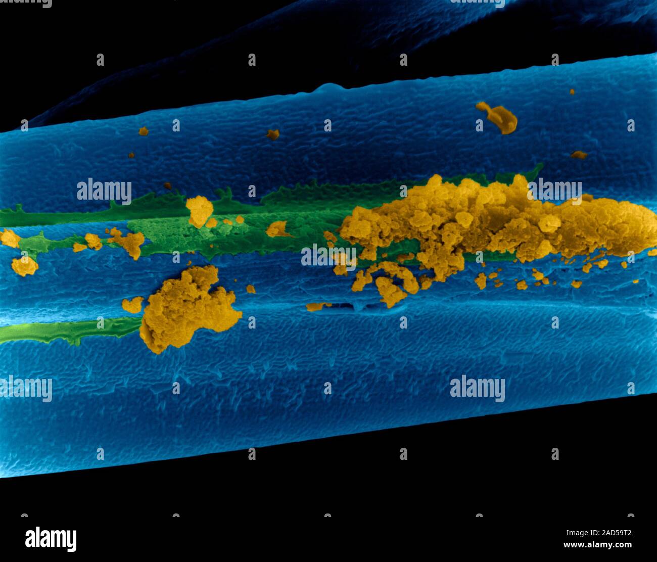 Tobacco smoke particles on the surface of a cigarette filter fibre ...