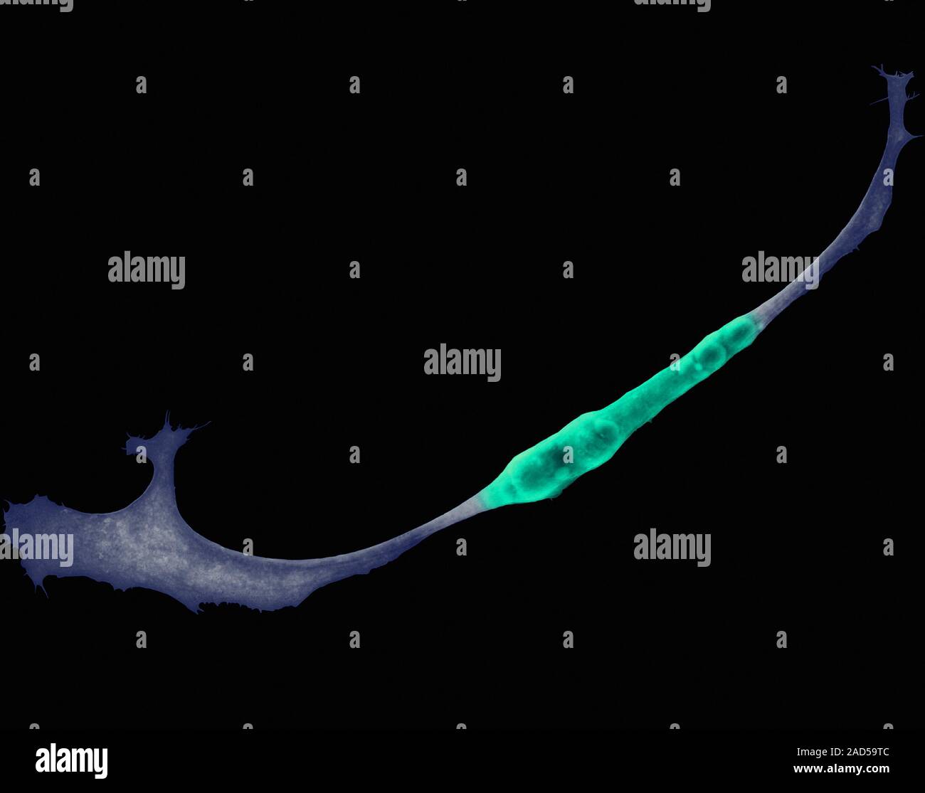 Human skeletal muscle from myoblast cell line (HSkM) in culture ...