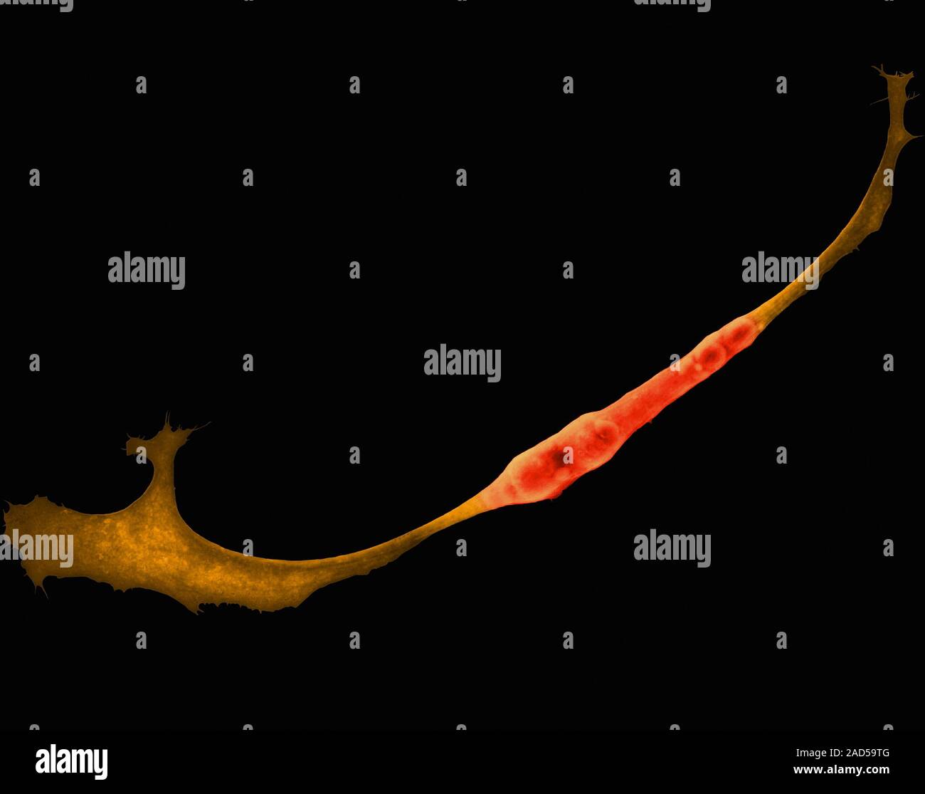 Human skeletal muscle from myoblast cell line (HSkM) in culture ...