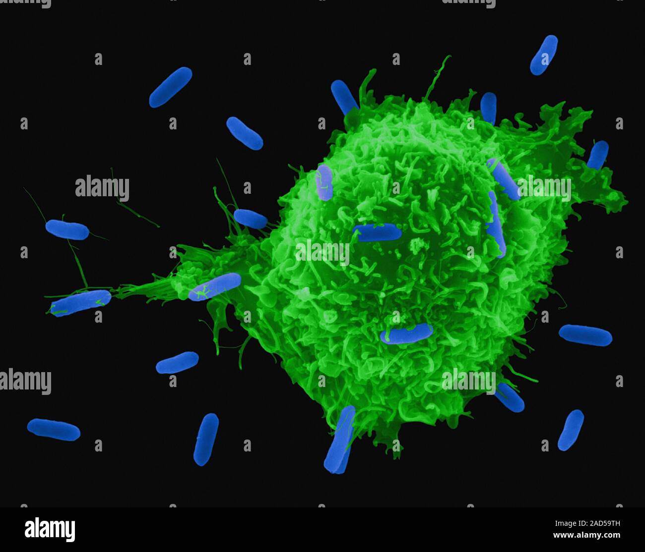 Peritoneal macrophage phagocytosis of E. coli, coloured scanning ... Peritoneal macrophage phagocytosis of E. coli, coloured scanning ...