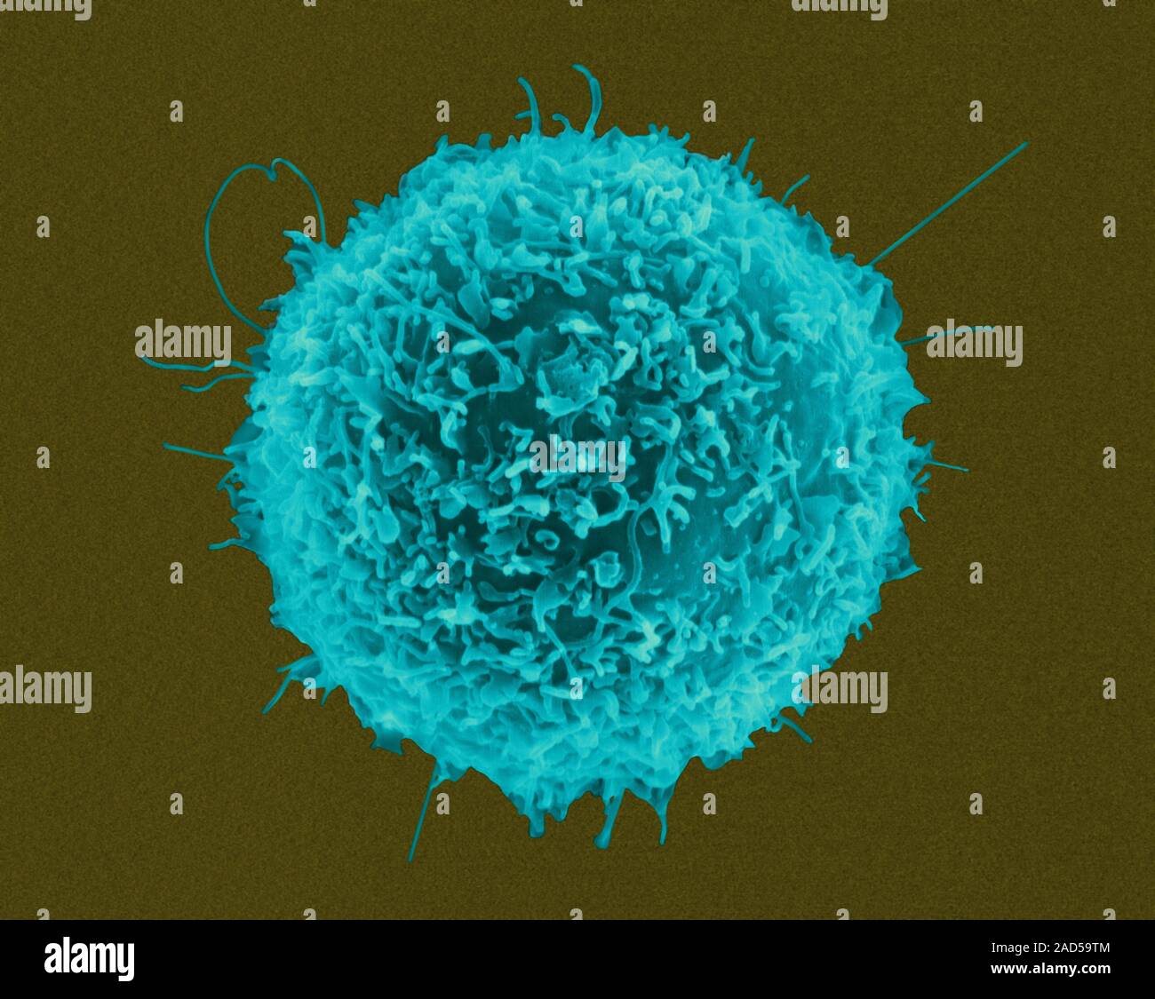 Human T lymphocyte (pre-T cell), coloured scanning electron micrograph ...
