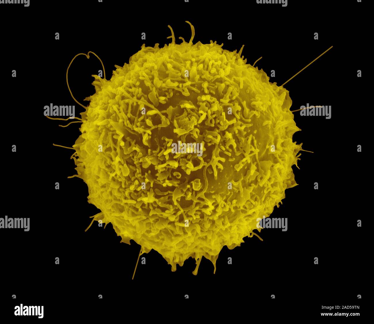 Human T lymphocyte (pre-T cell), coloured scanning electron micrograph ...