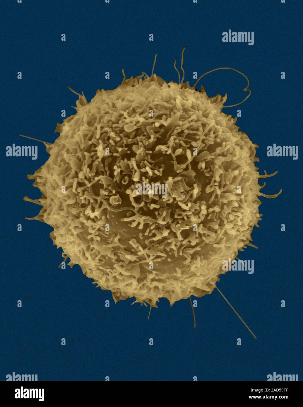 Human T lymphocyte (pre-T cell), coloured scanning electron micrograph ...