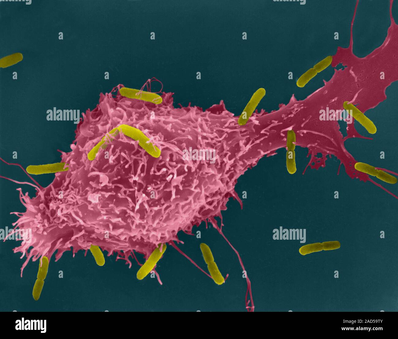 Peritoneal macrophage phagocytosis of E. coli, coloured scanning ... Peritoneal macrophage phagocytosis of E. coli, coloured scanning ...