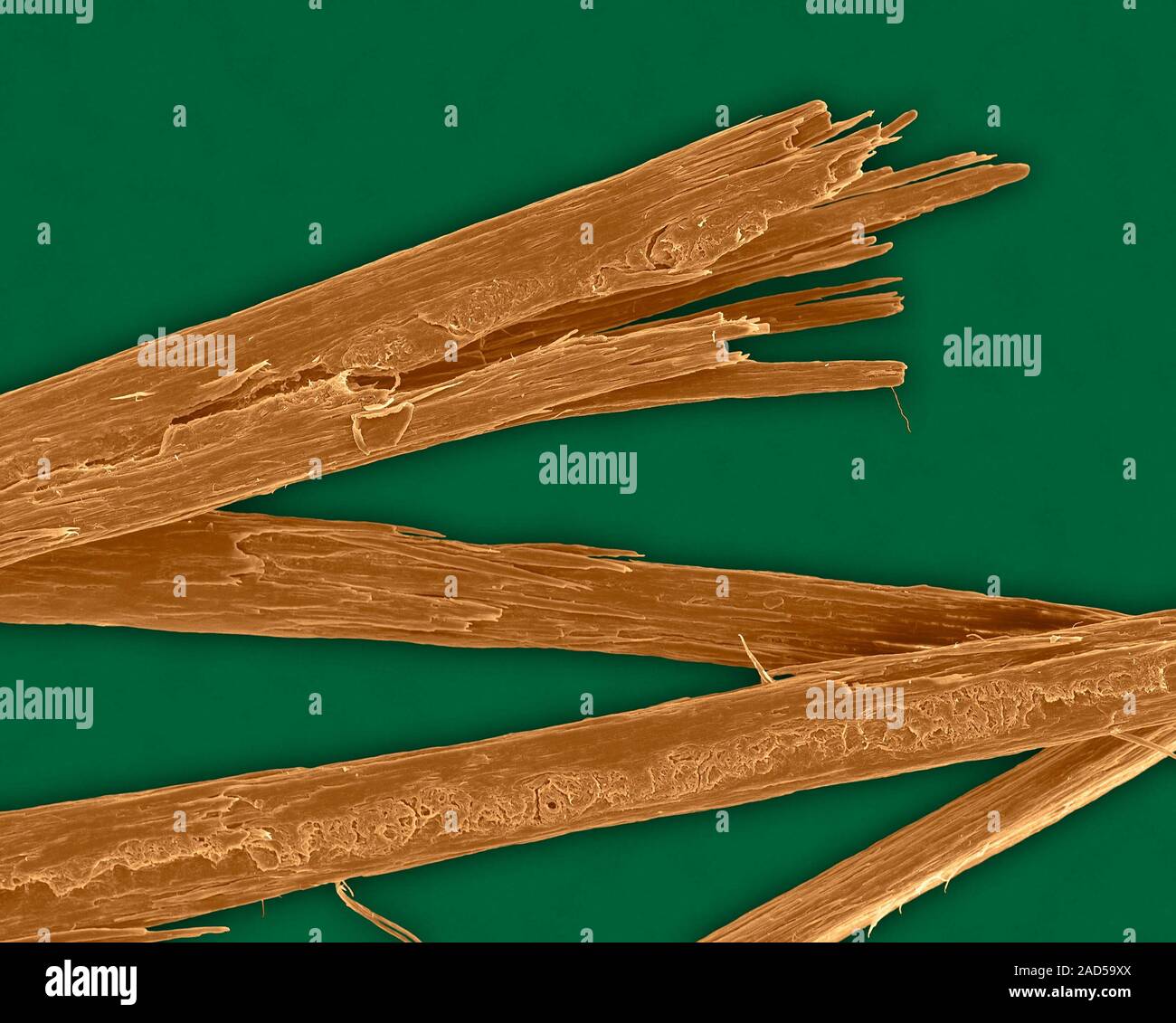 Human hair with split ends, coloured scanning electron micrograph (SEM ...