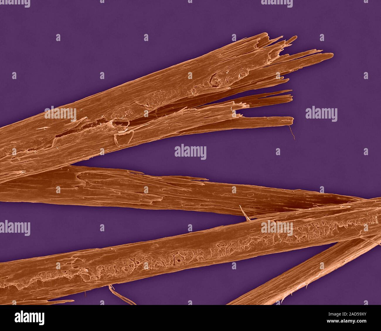 Human hair with split ends, coloured scanning electron micrograph (SEM ...