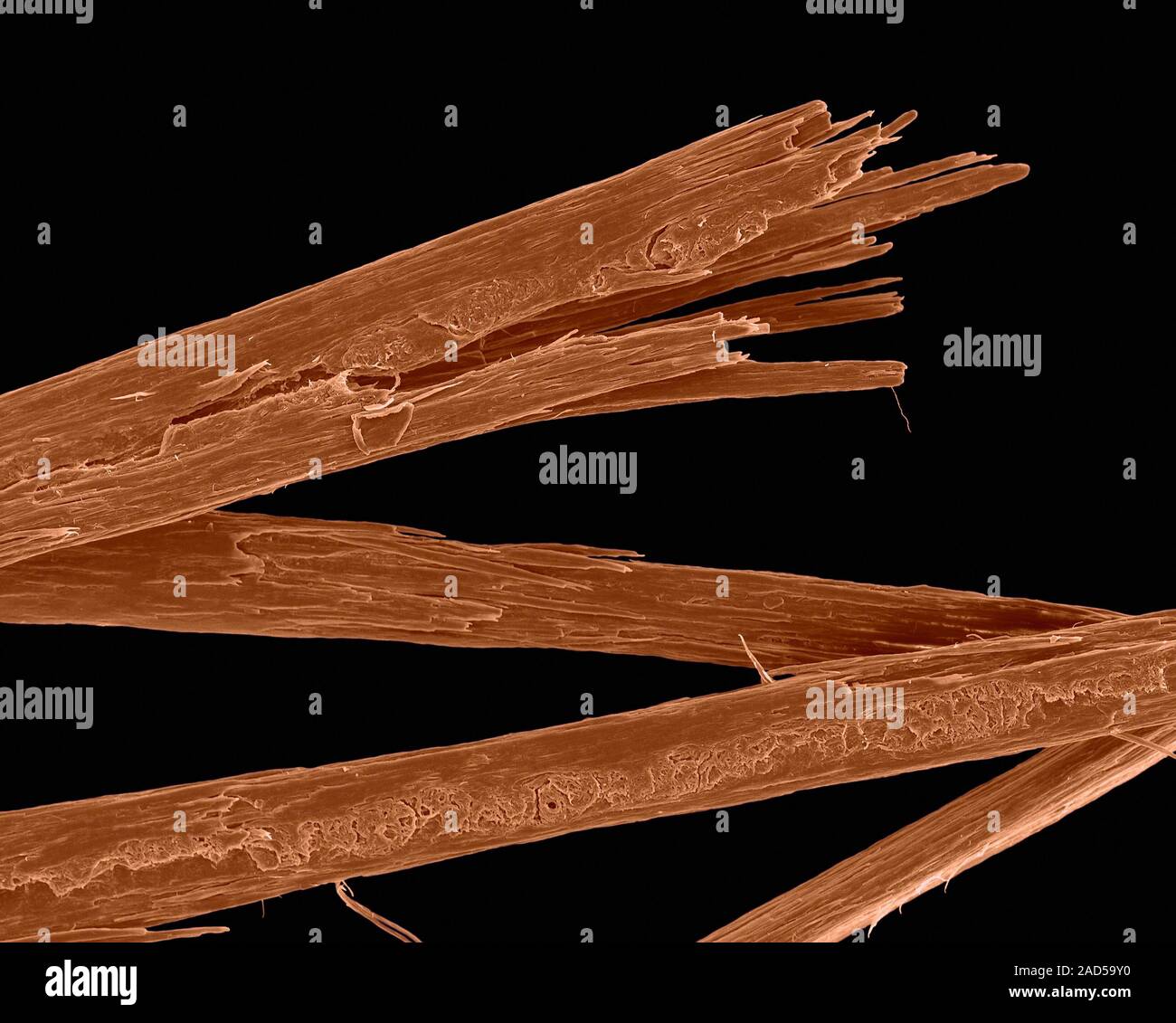 Human hair with split ends, coloured scanning electron micrograph (SEM ...
