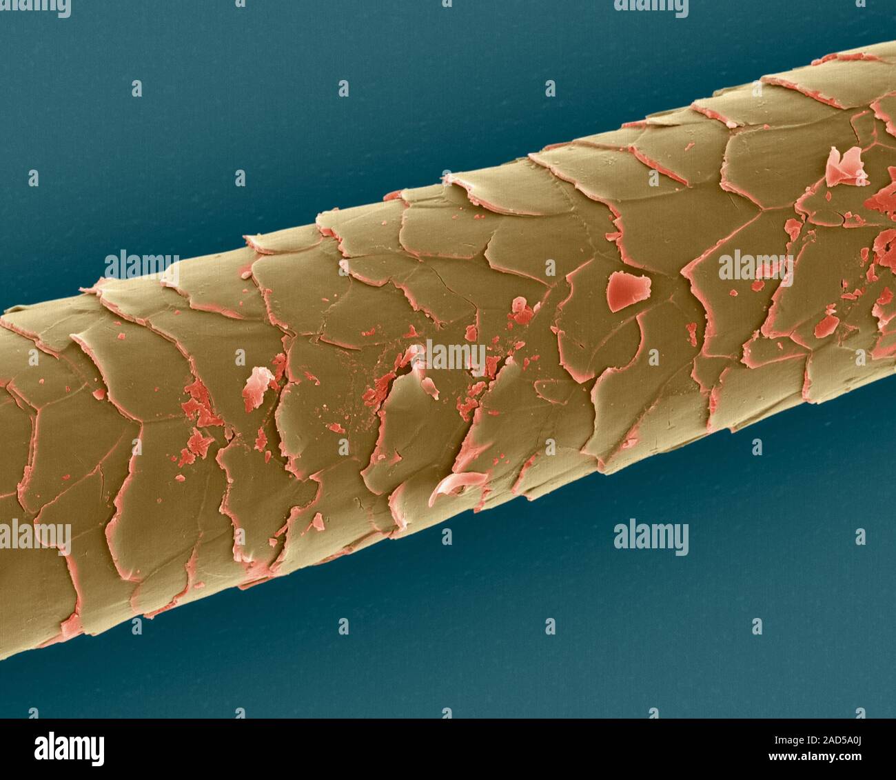 Human hair with damaged cuticle, coloured scanning electron micrograph ... Human hair with damaged cuticle, coloured scanning electron micrograph ...