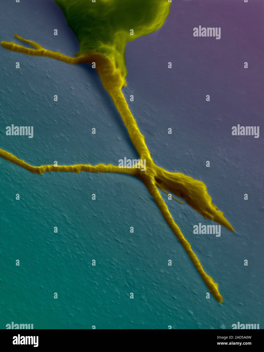 Cortical brain neurons (nerve cells) growing in culture, coloured ...