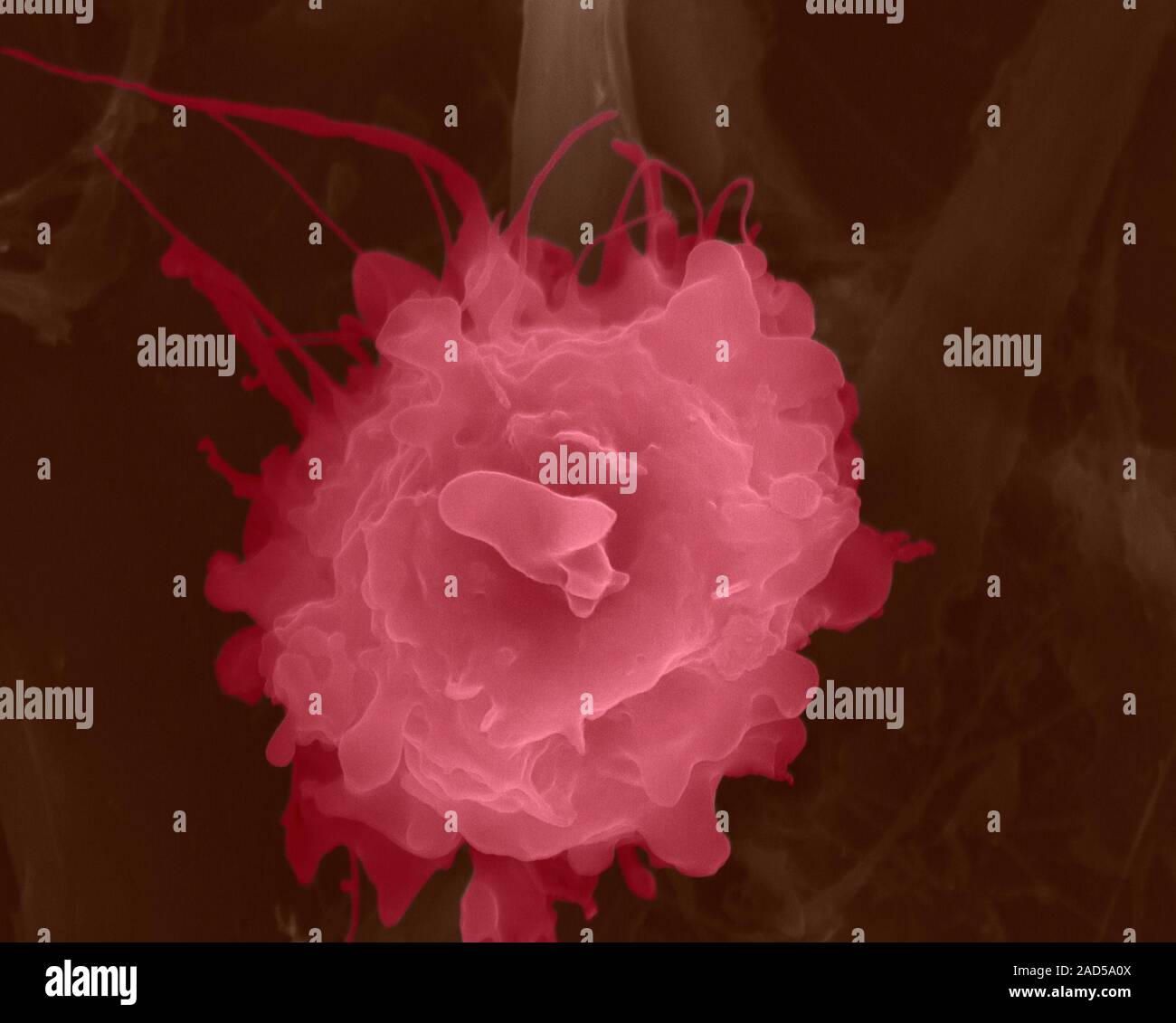 Apoptotic muscle cell; early stages of cell death (apoptosis), coloured ...