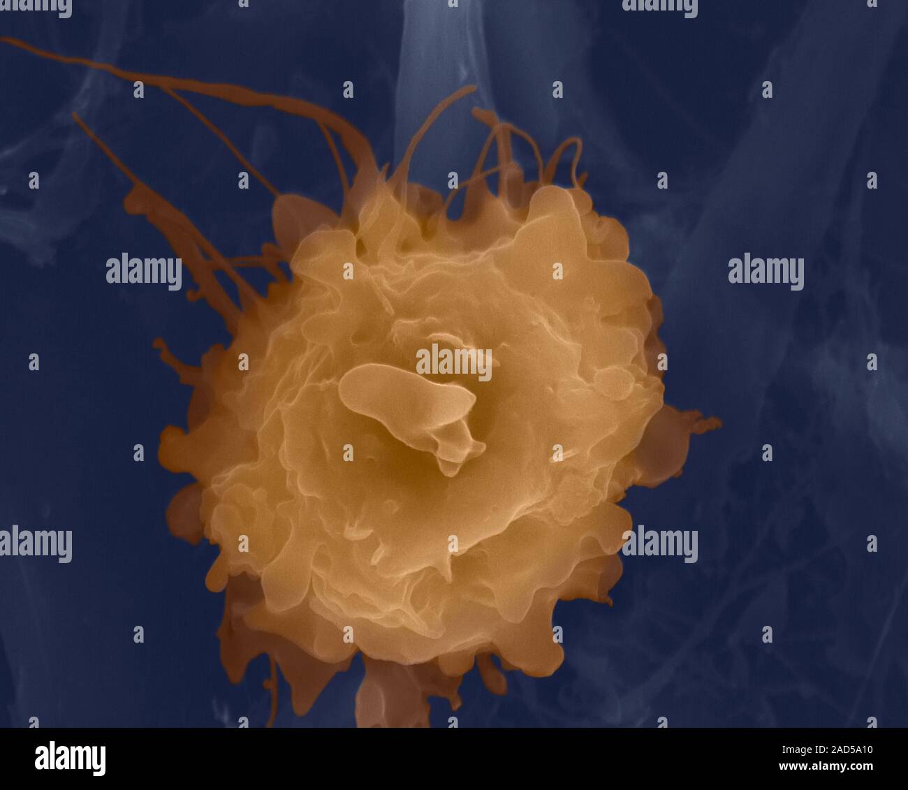 Apoptotic muscle cell; early stages of cell death (apoptosis), coloured ...