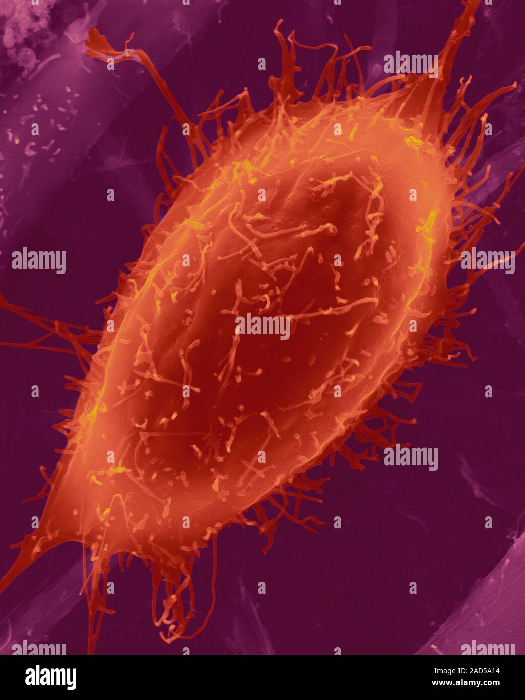 Muscle myoblast (primitive embryonic muscle cell) differentiating in to ...