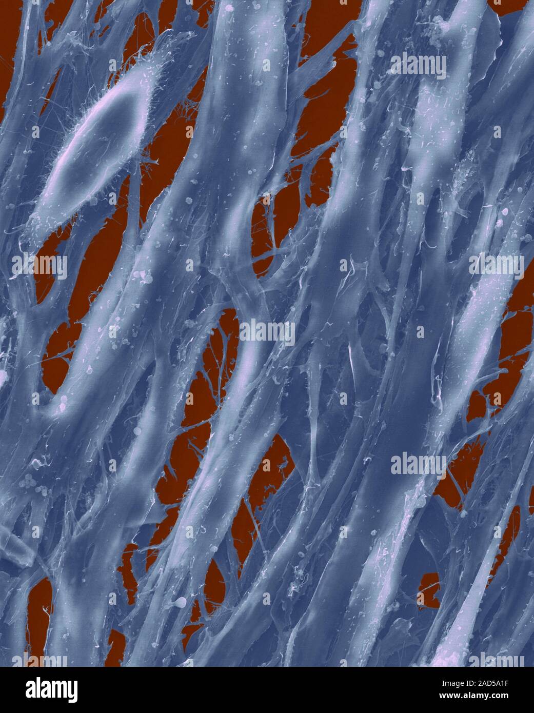 C2 skeletal muscle cells (myotubes) developing in culture, coloured scanning electron micrograph ...