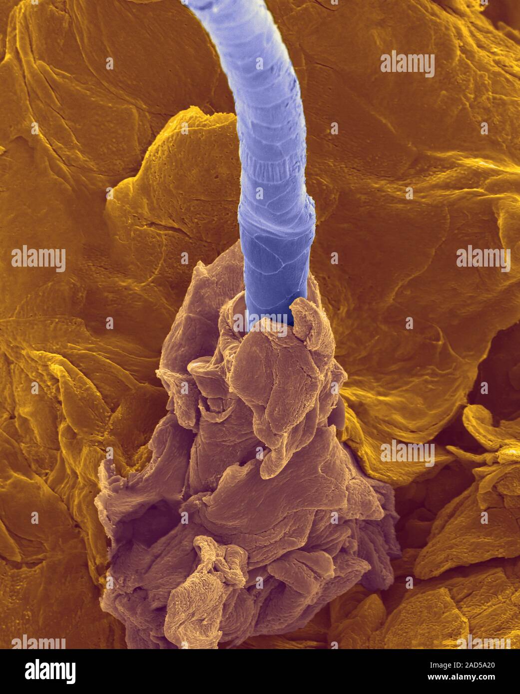 Human skin (epidermis) with hair emerging from hair follicle, coloured ...