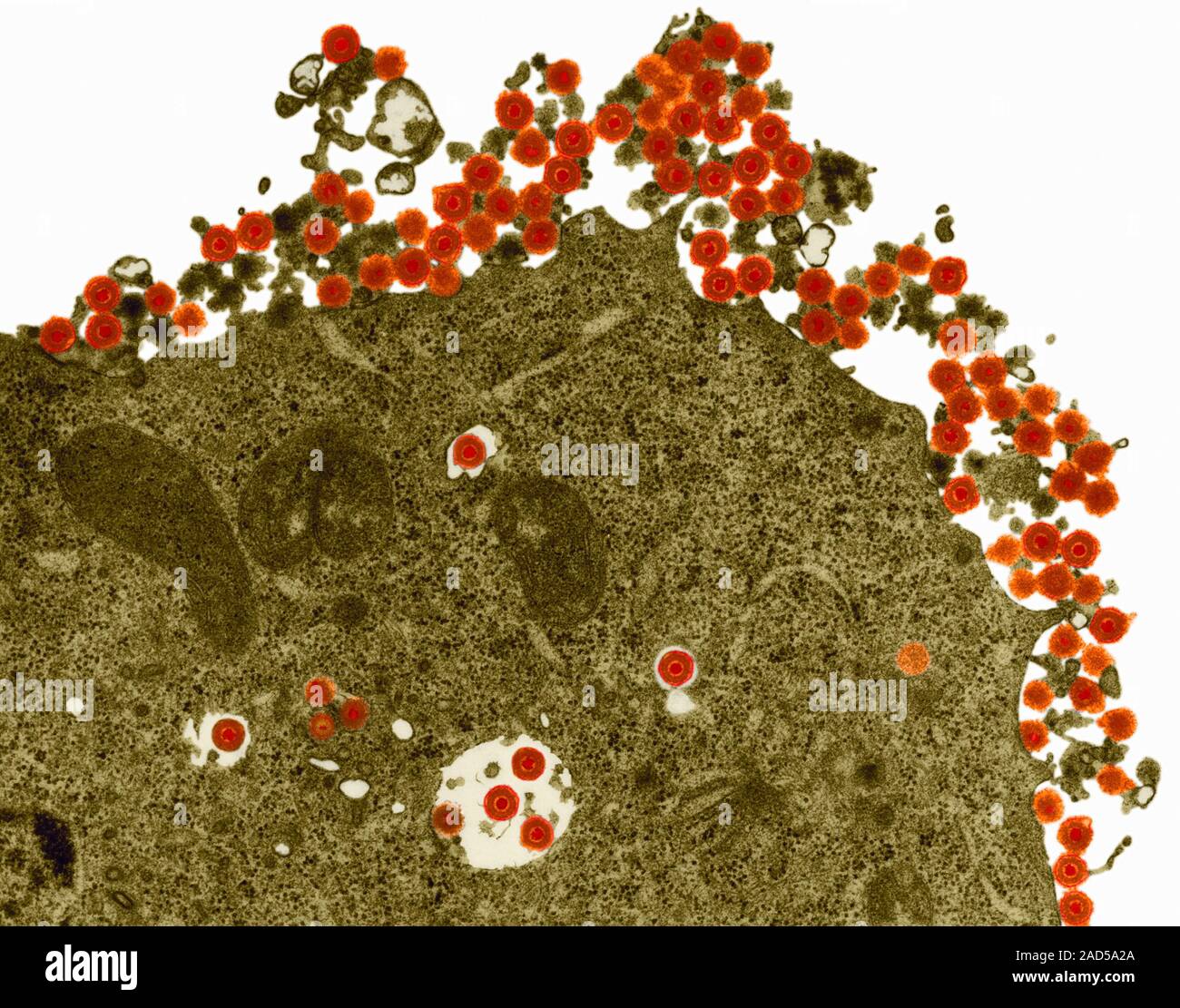 Herpes simplex virus (HSV-2, DNA virus) on and in a peripheral blood ...