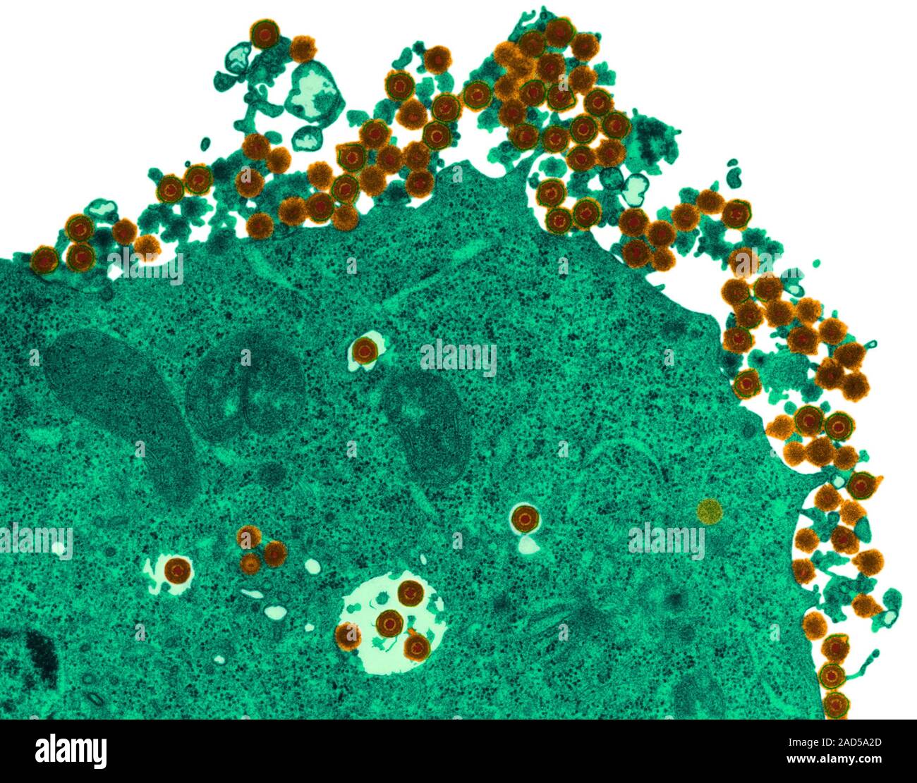 Herpes simplex virus (HSV-2, DNA virus) on and in a peripheral blood ...