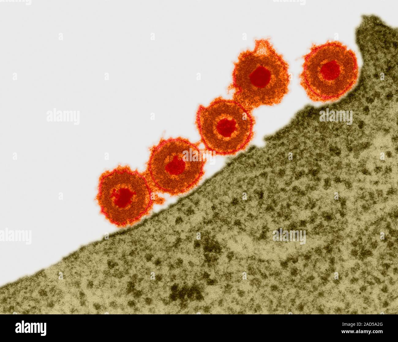 Herpes simplex virus (HSV-2, DNA virus) on a peripheral blood ...