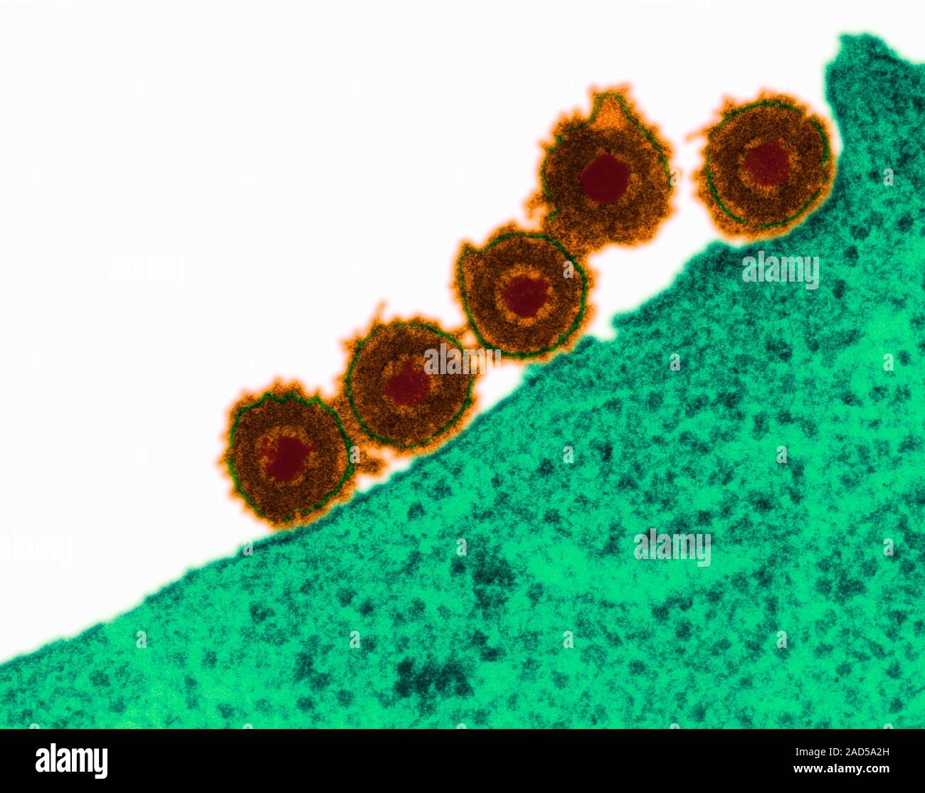 Herpes simplex virus (HSV-2, DNA virus) on a peripheral blood ...
