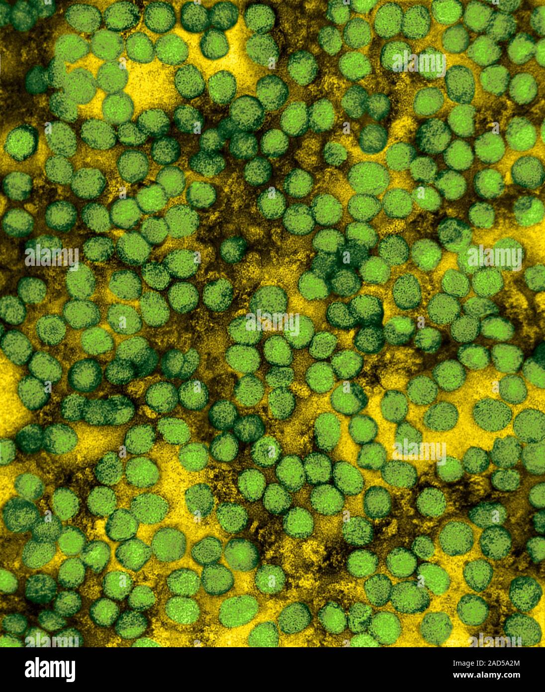 Yellow fever virus particles (virions), coloured transmission electron ...