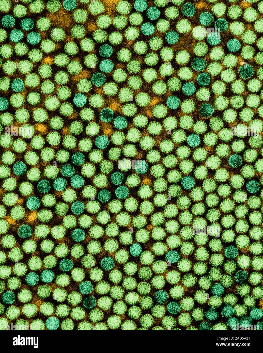 Hepatitis B virus (HBV) is the cause of serum hepatitis or hepatitis B ...