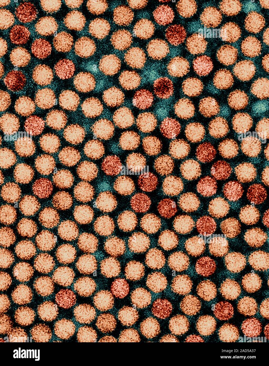 Hepatitis B virus (HBV) is the cause of serum hepatitis or hepatitis B ...