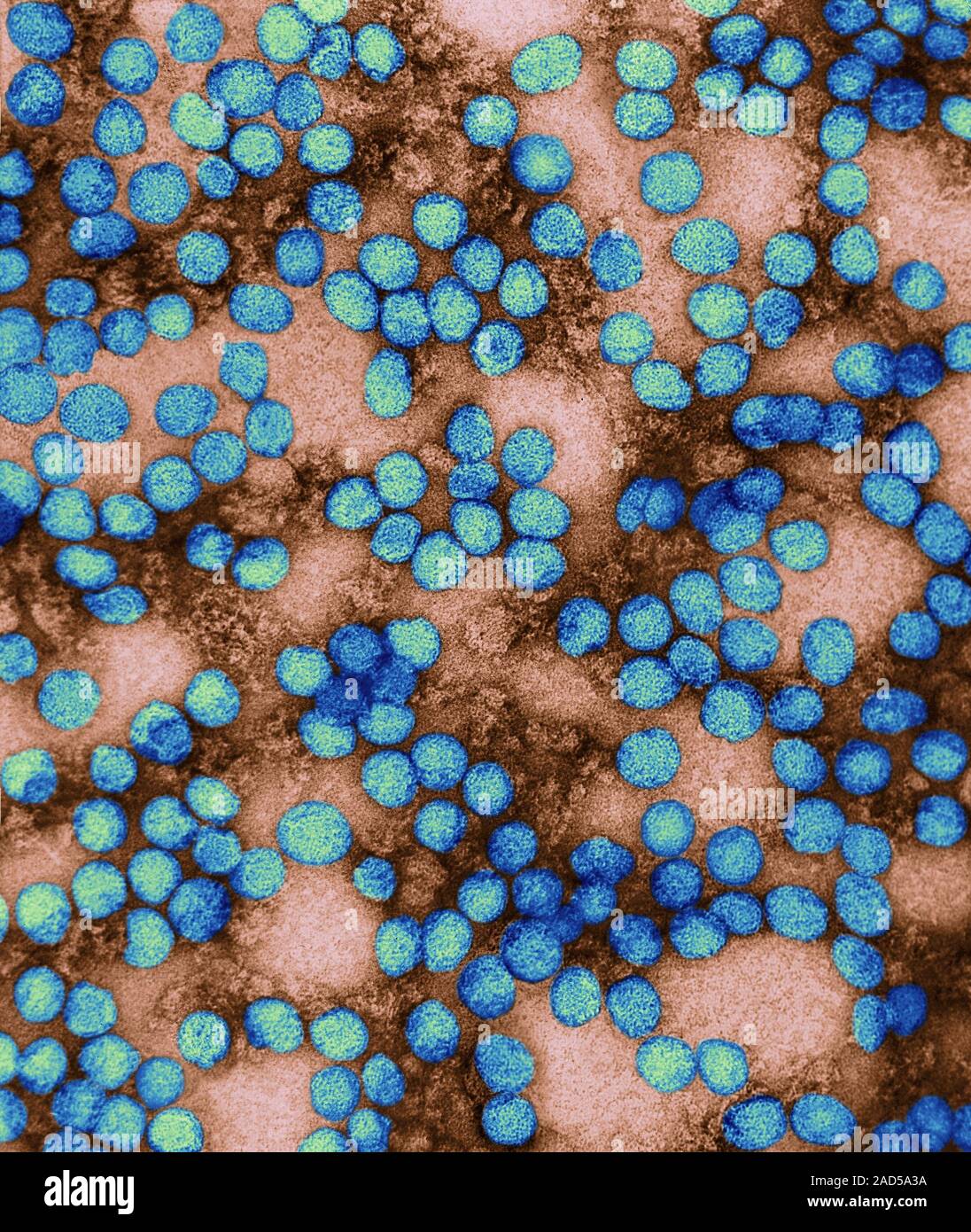 Yellow fever virus particles (virions), coloured transmission electron ...