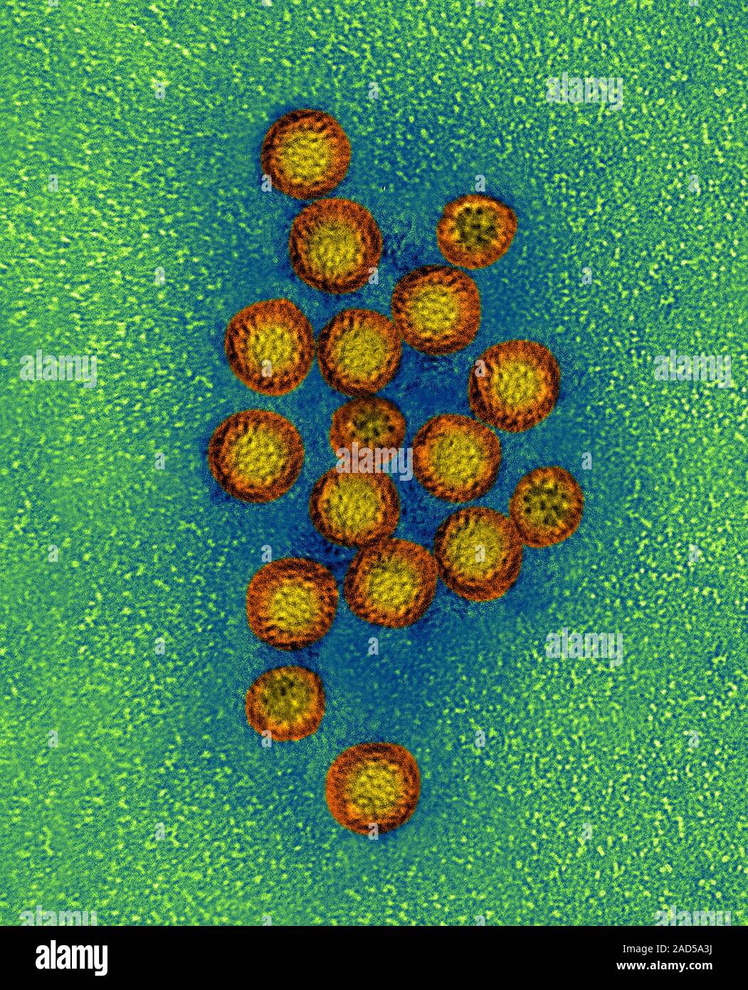Norovirus (Norwalk virus; RNA virus), coloured transmission electron micrograph (TEM). Norovirus ...