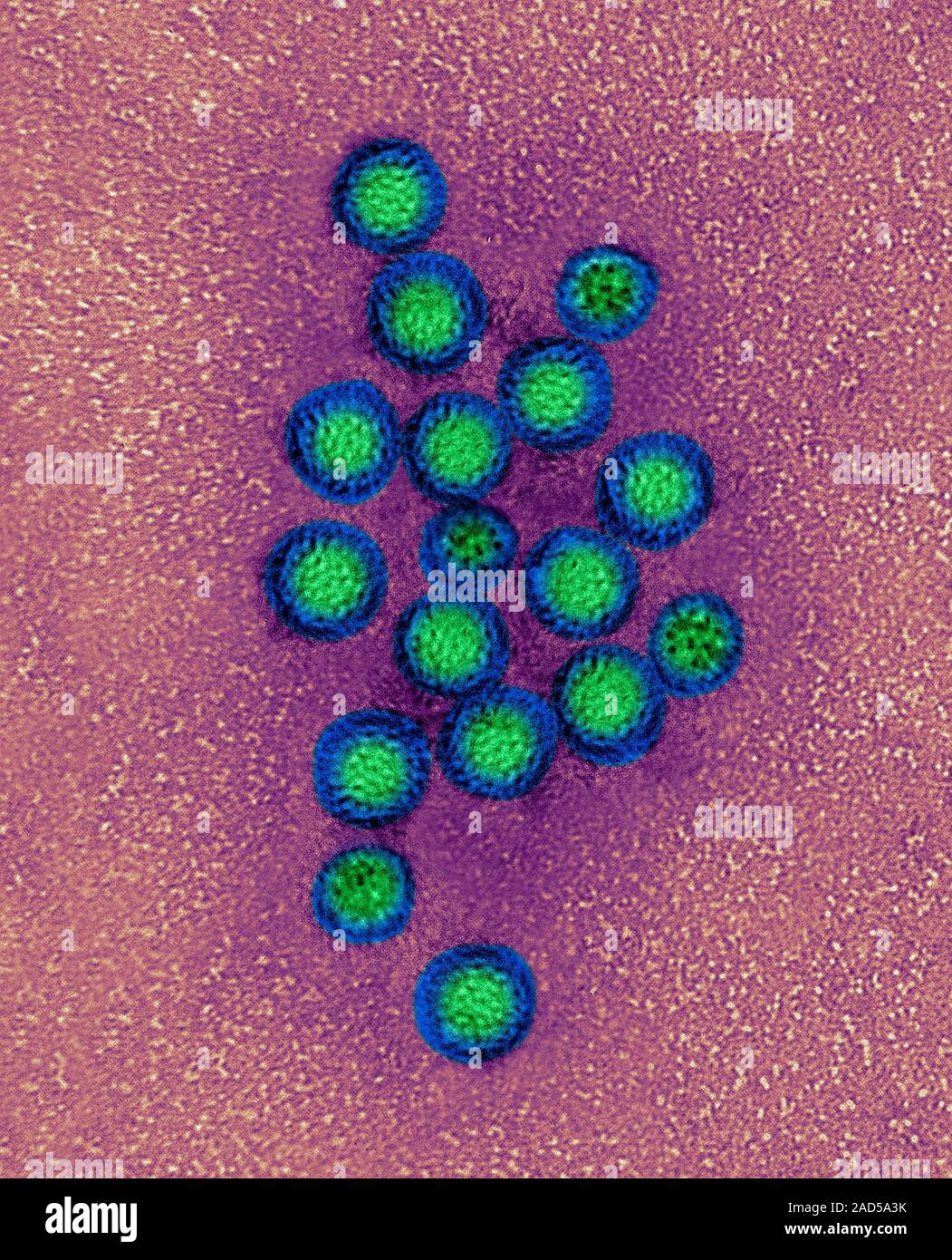 Norovirus (Norwalk virus; RNA virus), coloured transmission electron ...