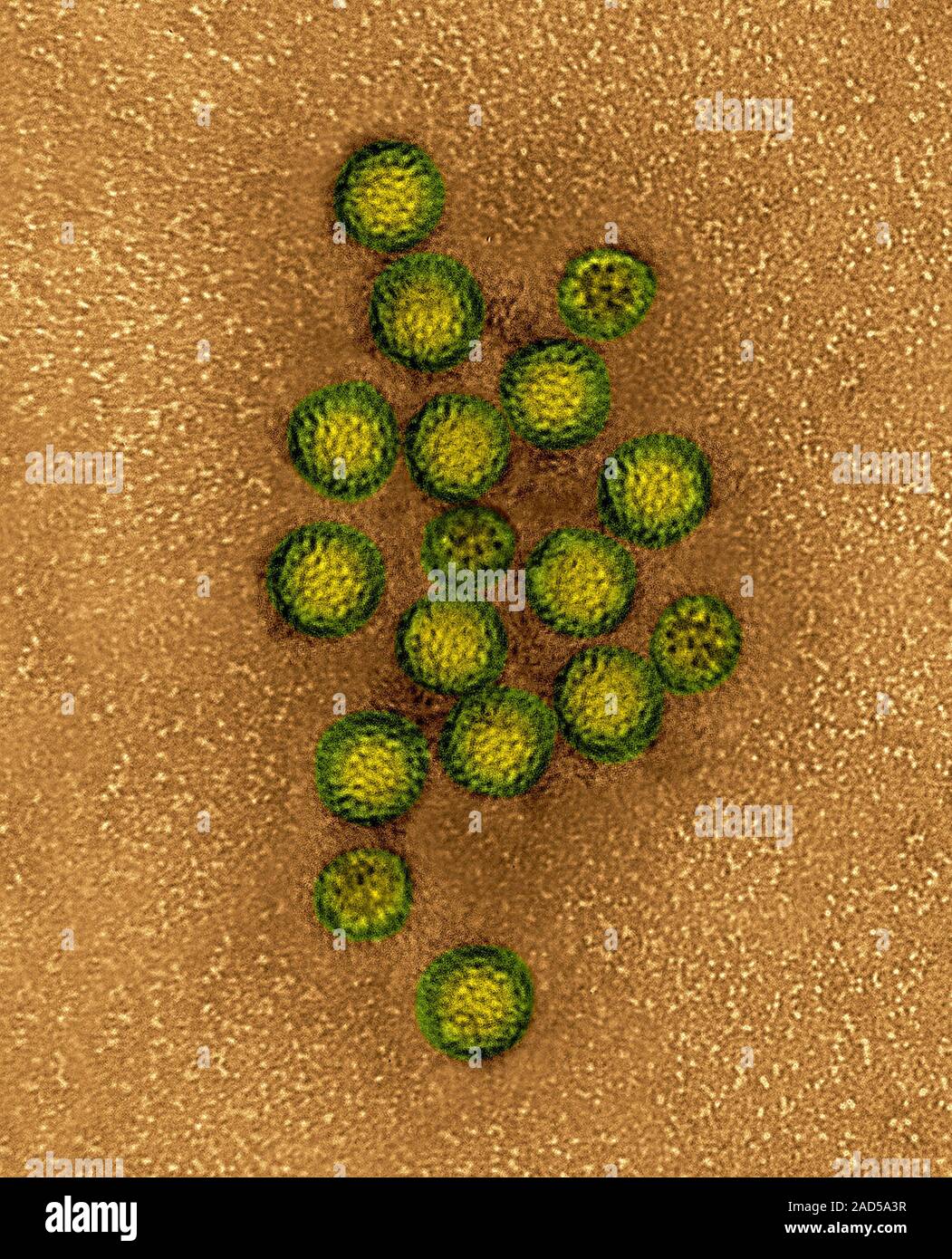 Norovirus (Norwalk virus; RNA virus), coloured transmission electron ...